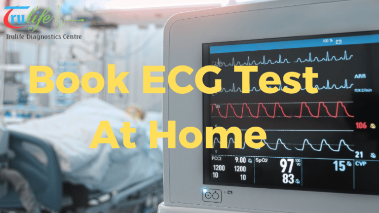 Book ECG Test At Home - Best Diagnostics Centre in Hyderabad - Trulife ...